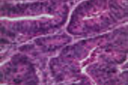 Implantable Drug Delivery Device Fights Cancer While Maintaining